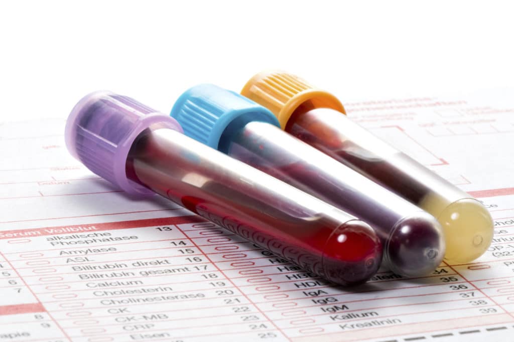 Complete Blood Count CBC Bioscint